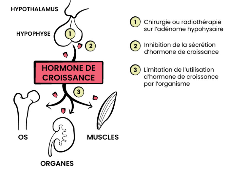 Traitements - acromegalie-asso